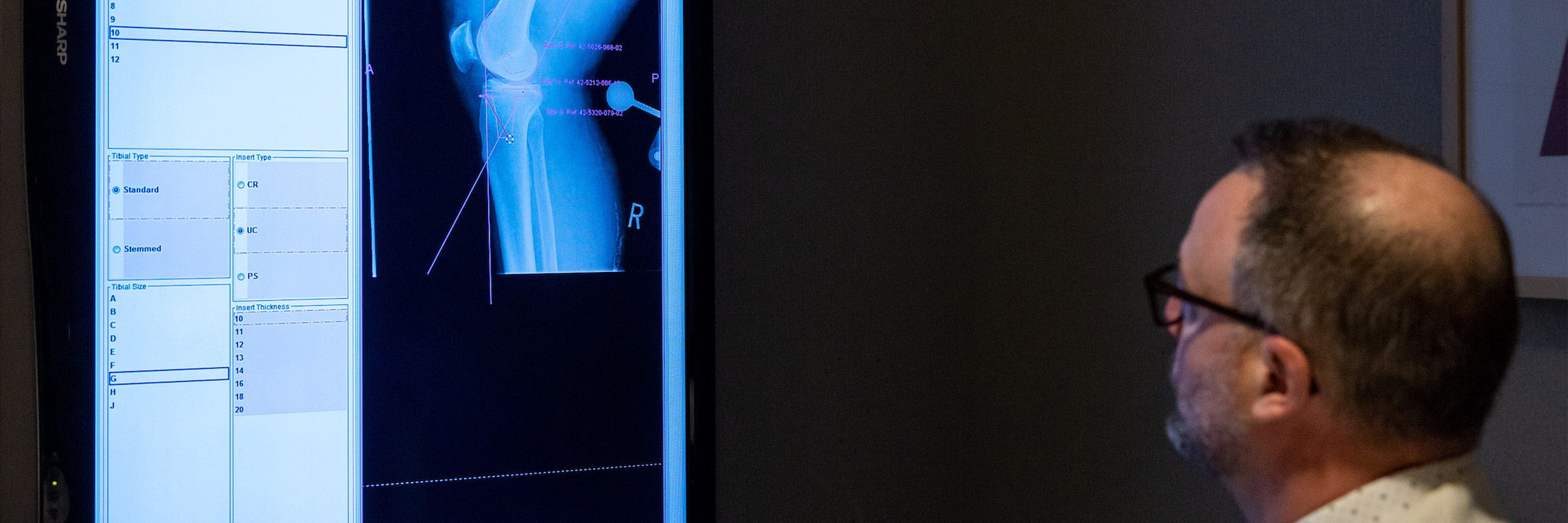 Limb Preservation | University of Iowa Health Care