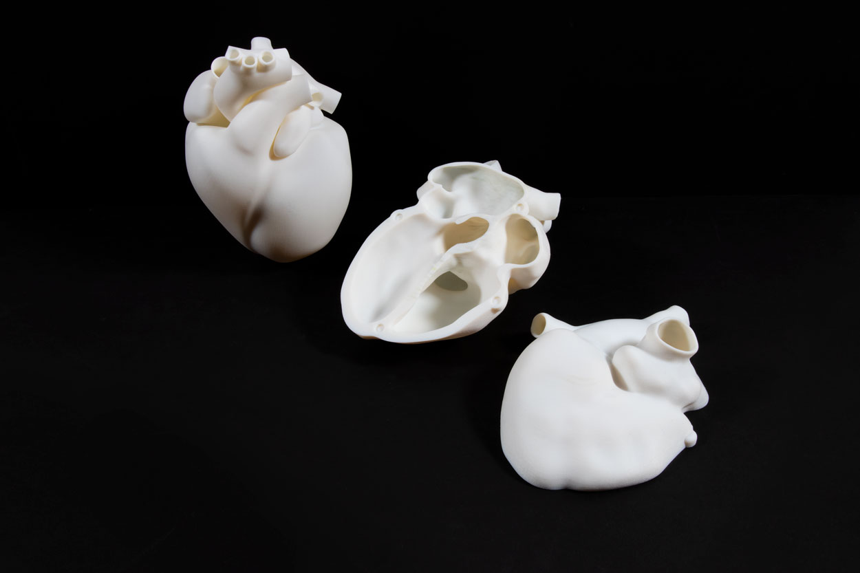 Cardiovascular Collaborations | University of Iowa Health Care