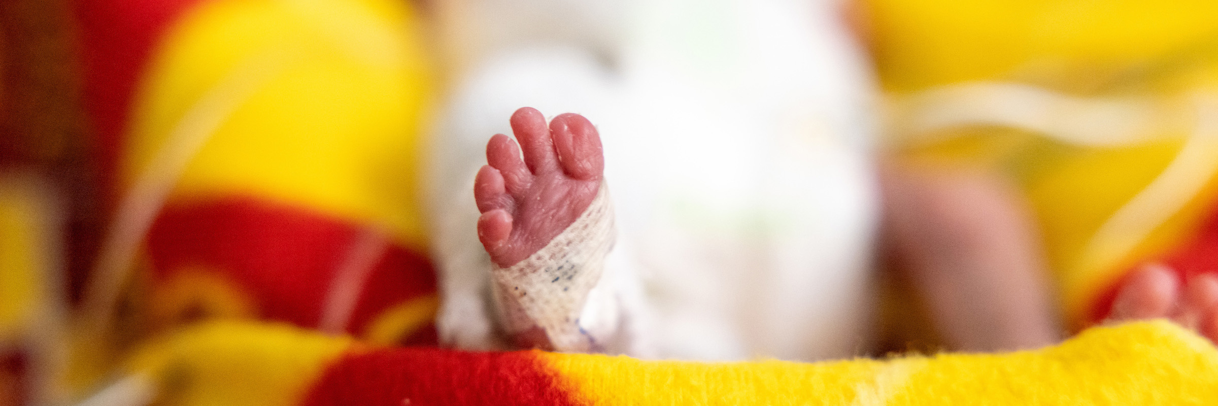 Multidisciplinary Care of Extremely Preterm Infants | Stead Family ...