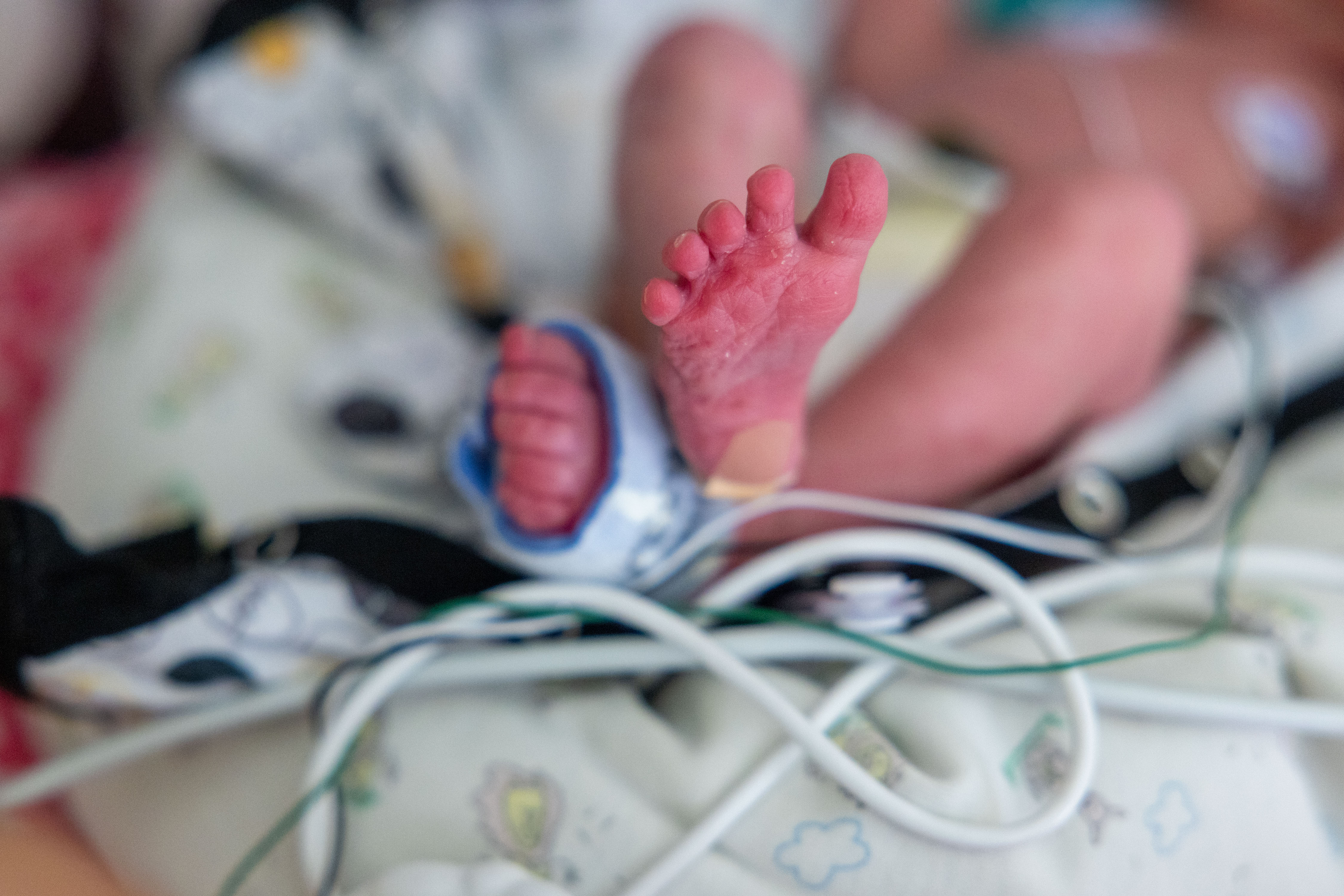 Expanding NICU care for our tiniest patients | Stead Family Children's ...