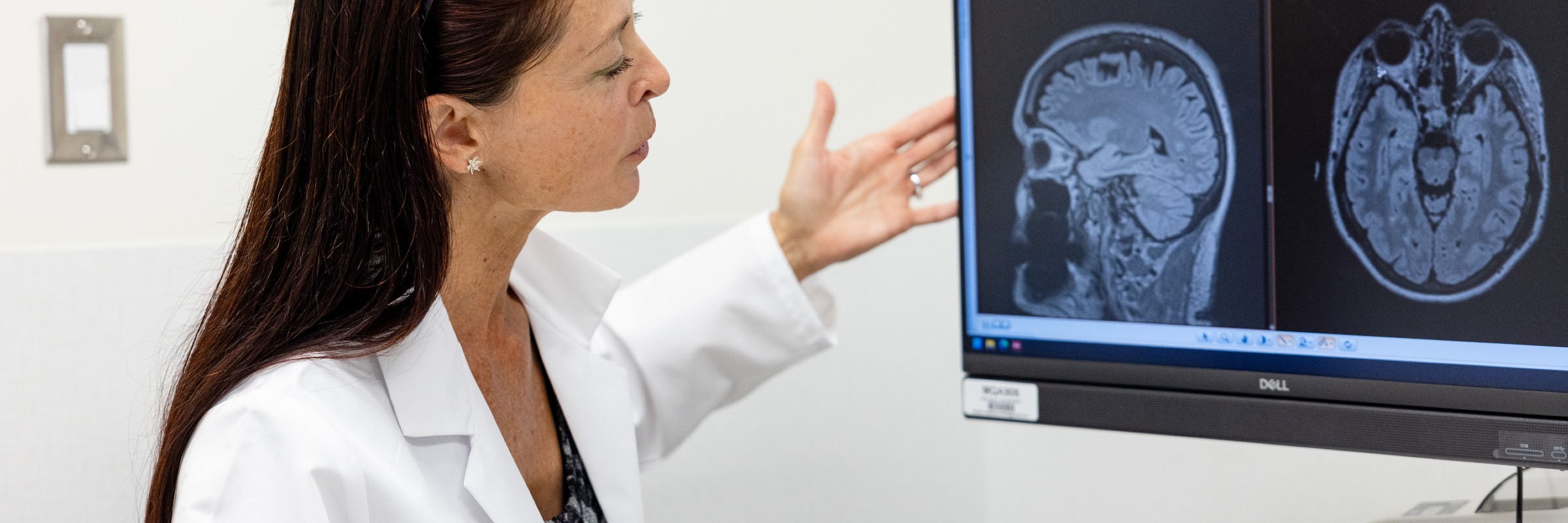 Neuroimmunology | University of Iowa Health Care