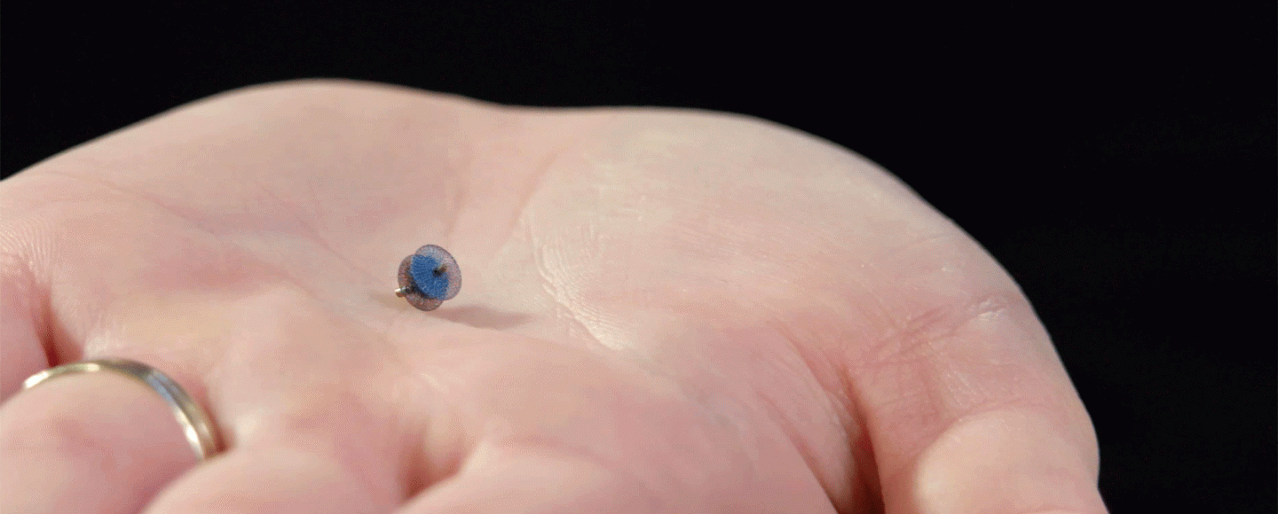 Tiny device advances treatment for newborns with heart defect | Stead ...