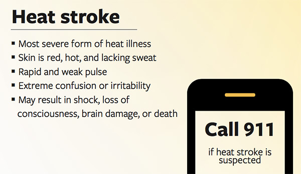 Heat stroke | University of Iowa Hospitals & Clinics